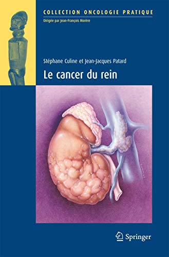 Le Cancer du Rein (Oncologie Pratique) (French Edition) Stephane Culine ...