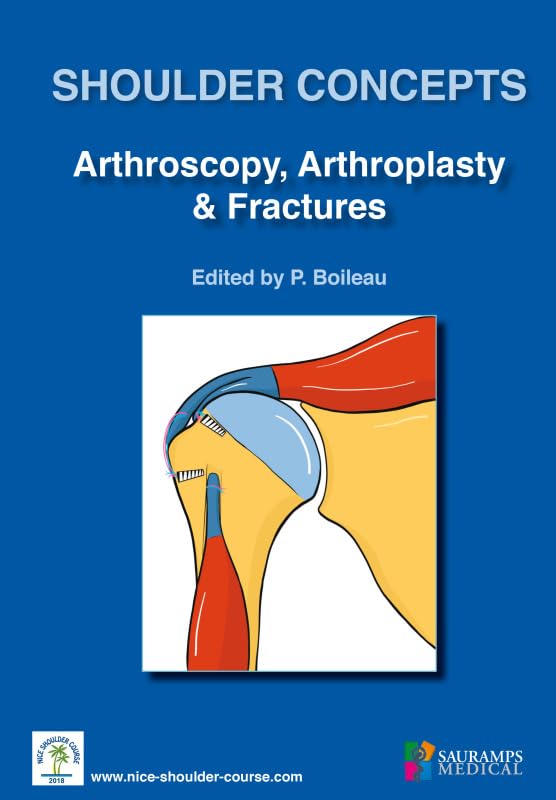 Shoulder Concepts Arthroscopy Arthrosplasty & Fractures, Pascal Boileau ...